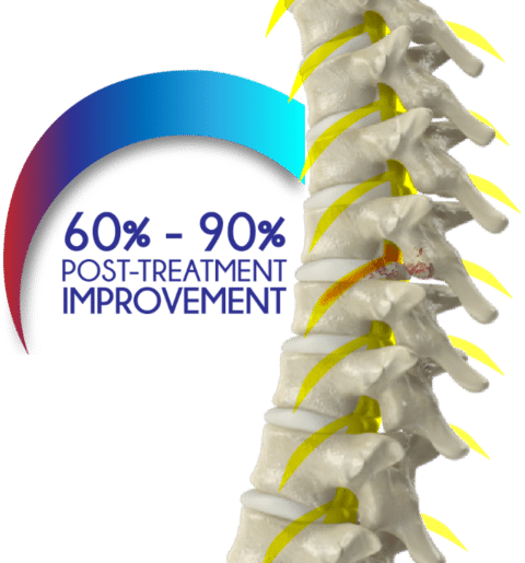 Harvard Trained Spine & Joint Doctors | Spinal Stenosis Causes ...